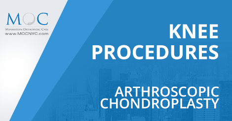 Arthroscopic Chondroplasty New York | Staten Island