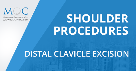 Distal Clavicle Excision Surgery in NYC & Staten Island