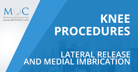 Lateral Release And Medial Imbrication Knee Surgery | Dr. Tehrany