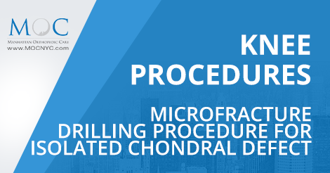 Microfracture Surgery | Knee Treatment NYC & Staten Island