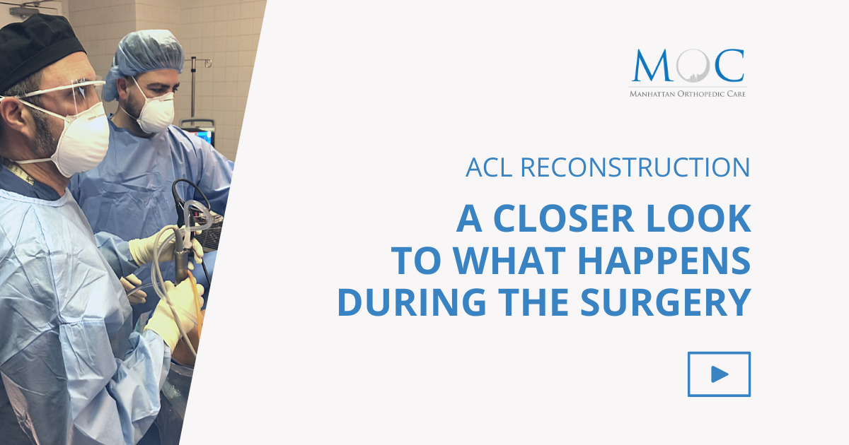 A closer look to an ACL reconstruction | Manhattan Orthopedic Care