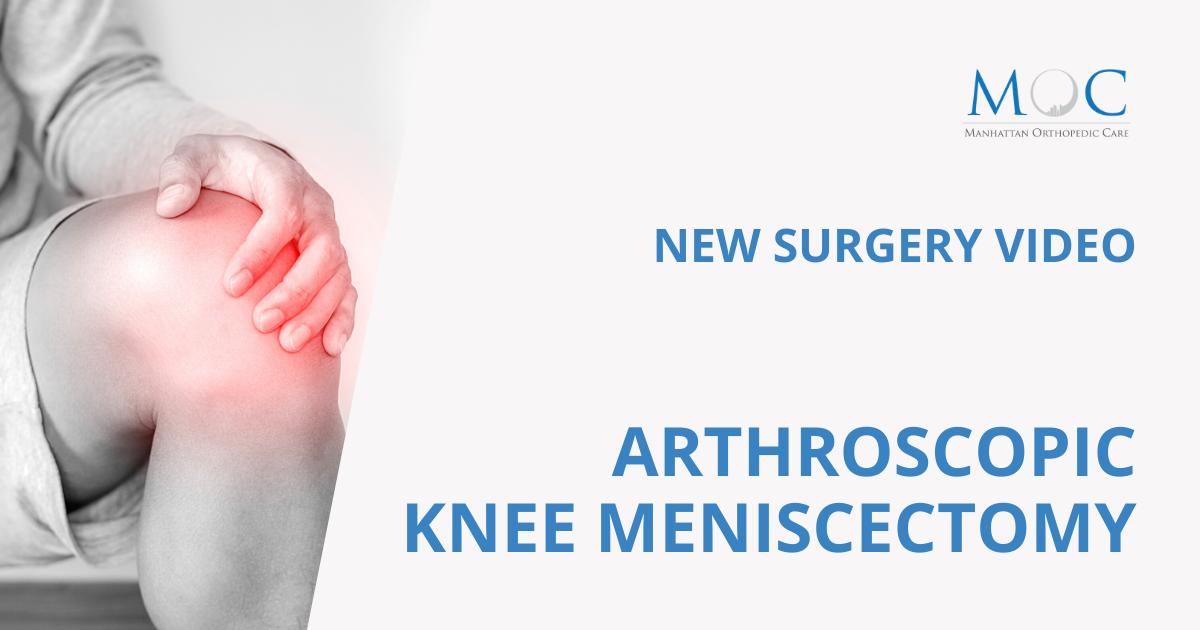 New surgery video: Arthroscopic Knee Meniscectomy | Manhattan ...