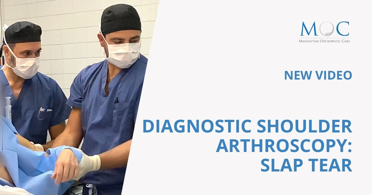 Shoulder Arthrospcopy led to SLAP Tear | Manhattan Orthopedic Care